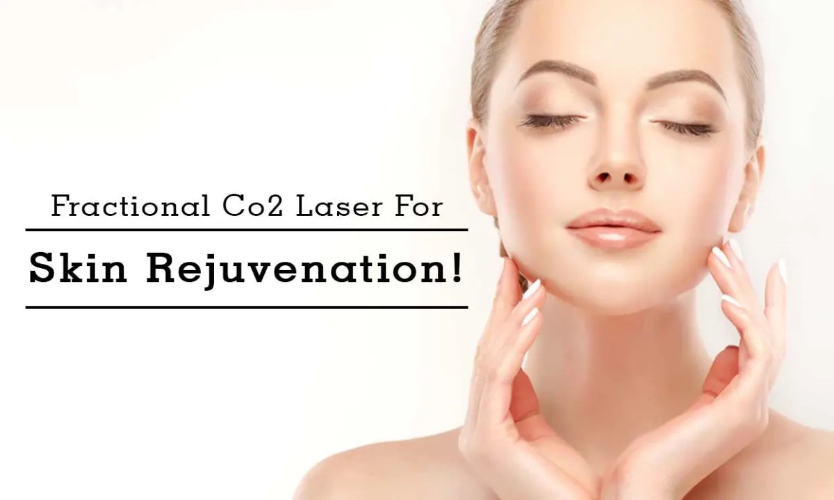 The Ultimate Guide To Co2 Laser Treatments Rejuvenate Your Skin Safely