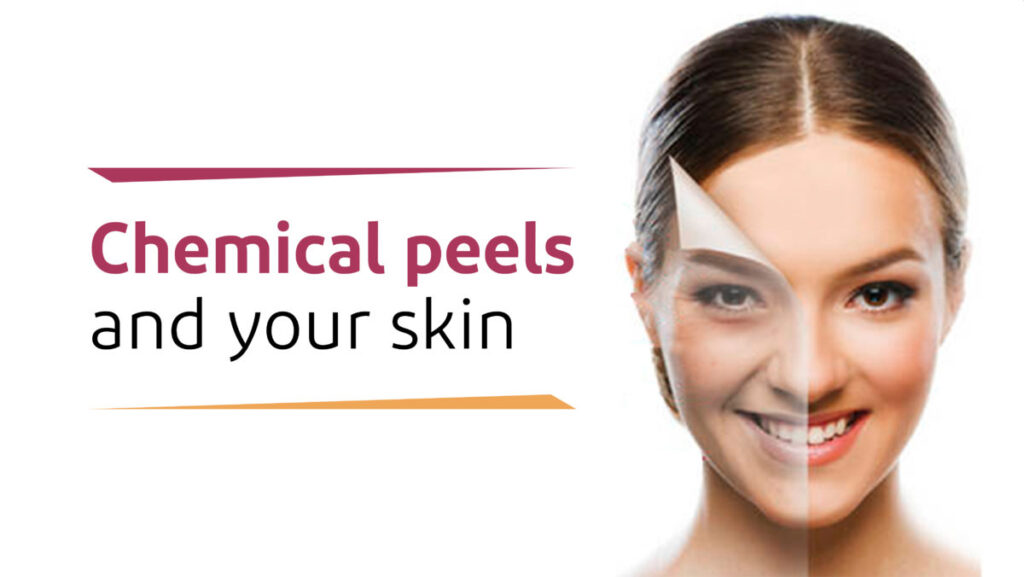 Chemical Peels Demystified: A Deep Dive into Skin Renewal - Glō Skin ...
